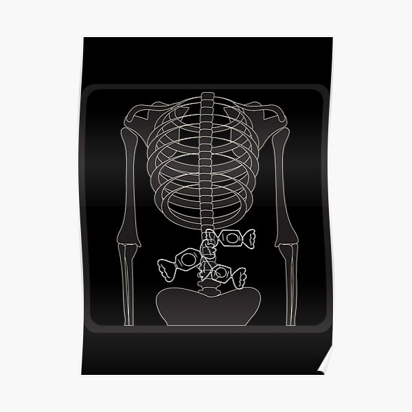 "Skeleton Candy X-Ray Halloween " Poster for Sale by SquishyTees ...