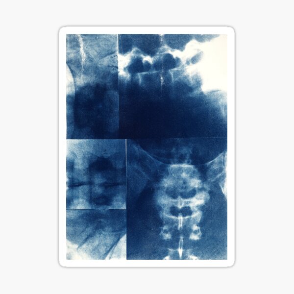 "Cyanotype Art Prints Graphic Art - X-rays Skeleton" Sticker for Sale ...