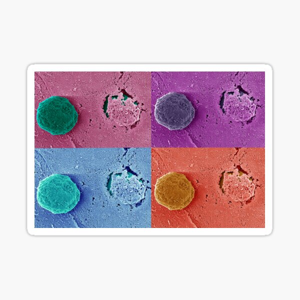 "T-cell Pop Art" Sticker for Sale by foxzami | Redbubble