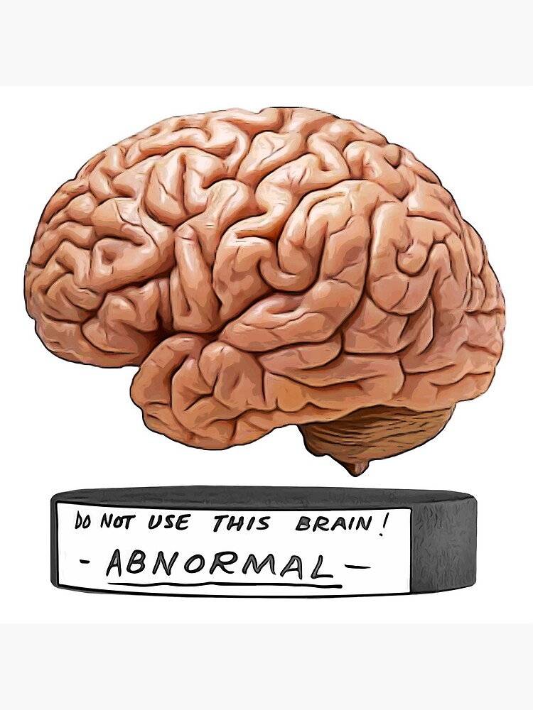 "Abnormal Brain from frankenstein junior movie" Poster for Sale by ...