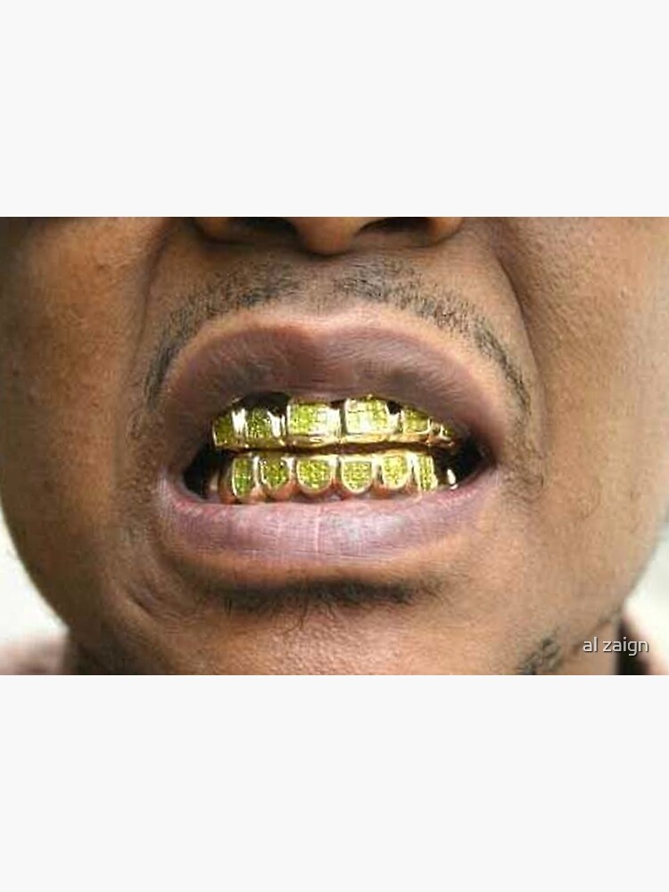 "Dental Gold tooth grills smiling man with teeth grill" Mask for Sale ...