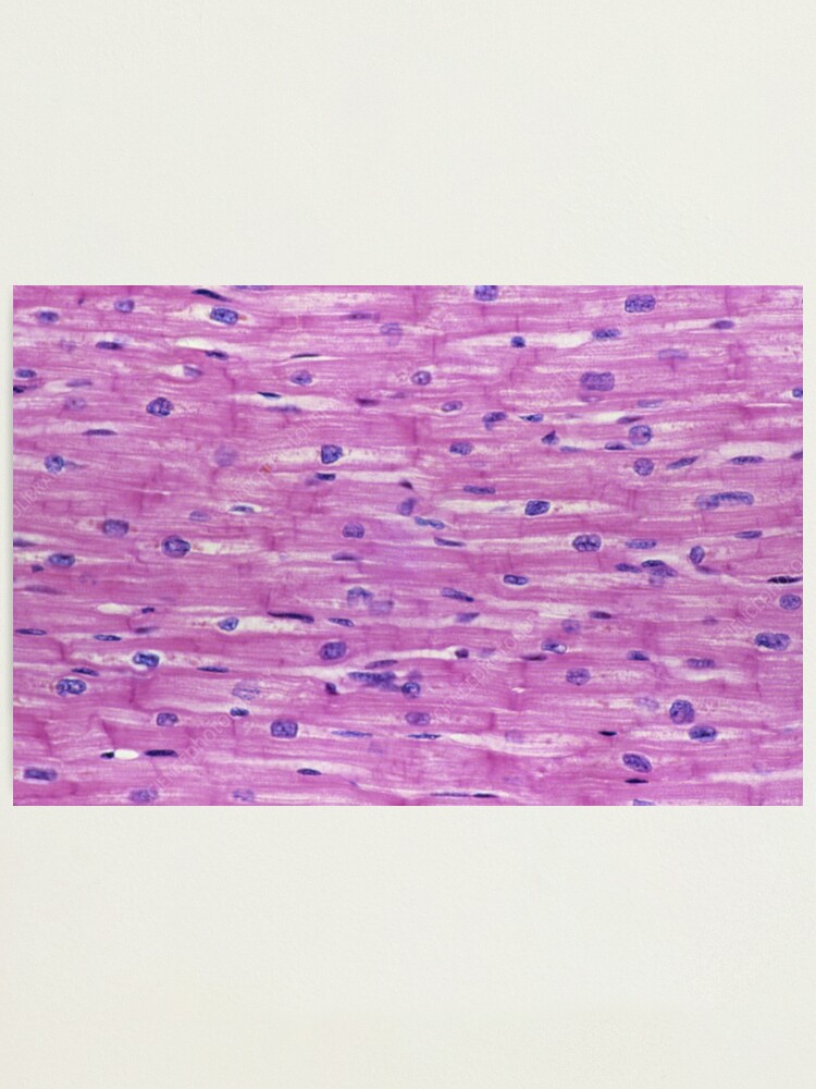 "Cardiac Muscle Under Microscope" Photographic Print by ACH-Designs ...