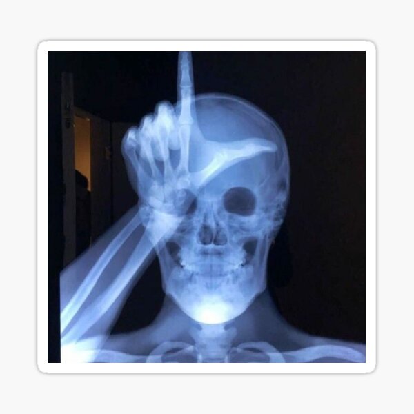 "loser skeleton" Sticker for Sale by MGRP | Redbubble
