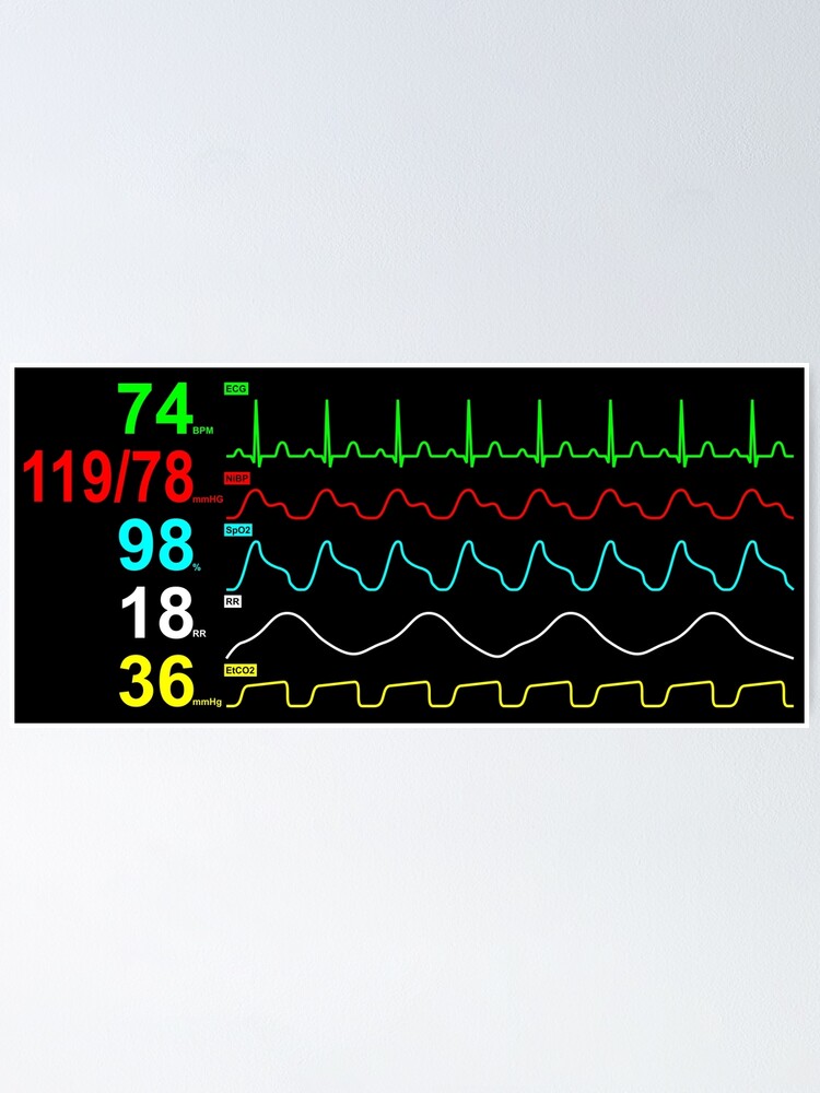 "Vital Signs" Poster for Sale by jwbentoniii | Redbubble