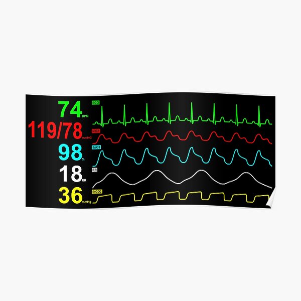 "Vital Signs" Poster for Sale by jwbentoniii | Redbubble