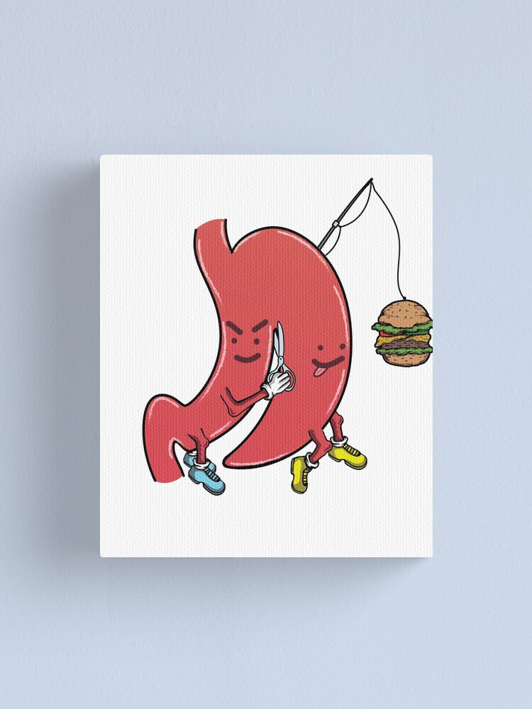 "Cartoon Gastrektomie Bariatric Surgery Geschenk" Leinwanddruck von ...