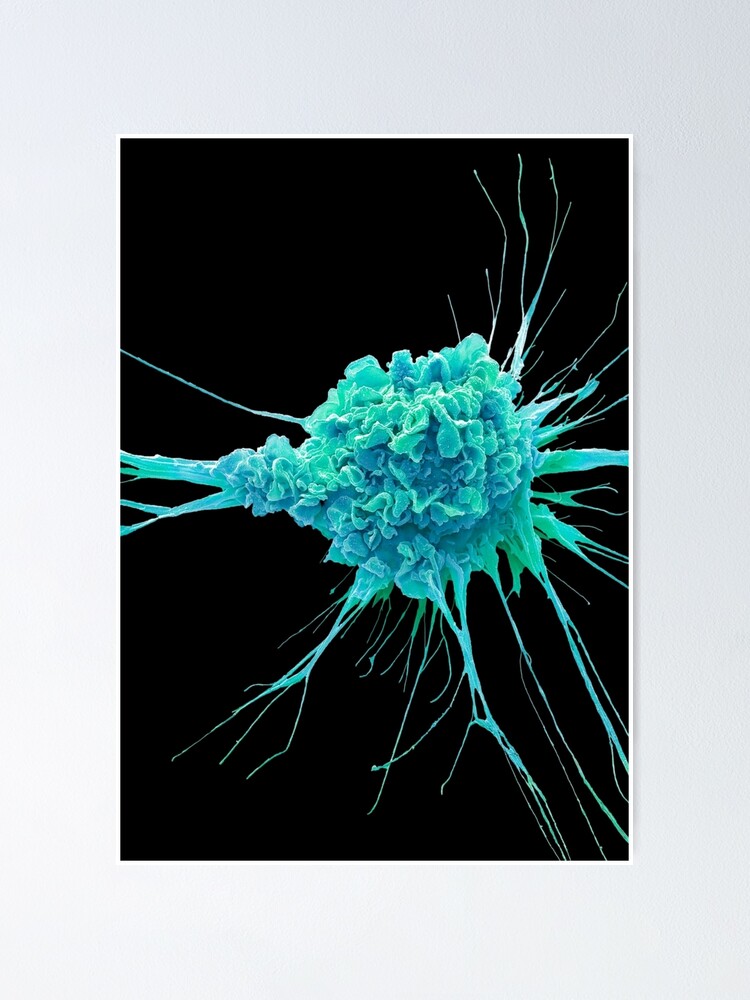 "SEM ANTIGEN DENDRIC CELL MEDICAL LABORATORY SCIENTIST" Poster by ...