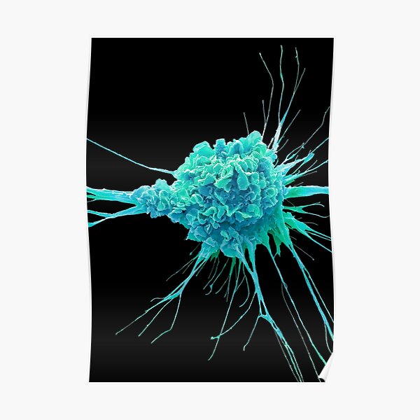 "SEM ANTIGEN DENDRIC CELL MEDICAL LABORATORY SCIENTIST" Poster by ...