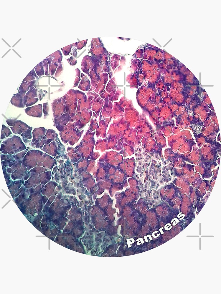 "Pancreas" Sticker for Sale by MVanHyll | Redbubble