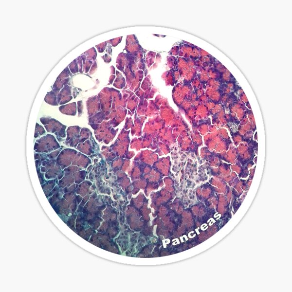 "Pancreas" Sticker for Sale by MVanHyll | Redbubble
