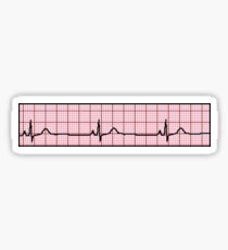 Ecg: Stickers | Redbubble
