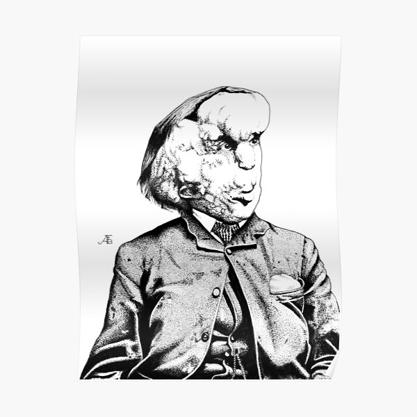 "Joseph Carey Merrick Portrait" Poster for Sale by wolfsbayn | Redbubble