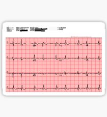 Ecg: Stickers | Redbubble