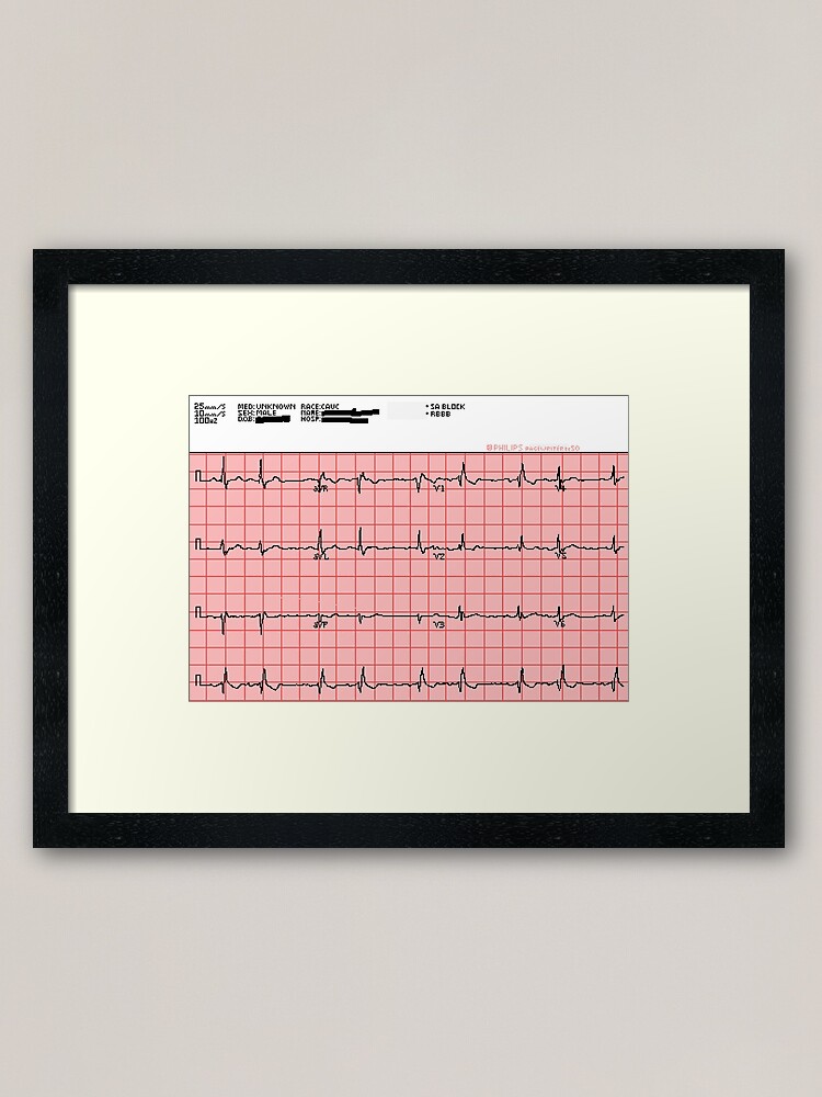 "Standard 12-Lead ECG" Framed Art Print for Sale by JohnnyCarotid ...