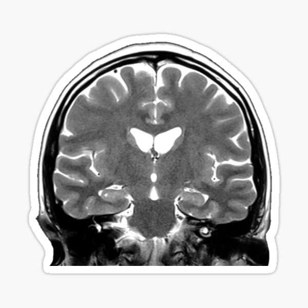 "Head MRI" Sticker by moth-creature | Redbubble