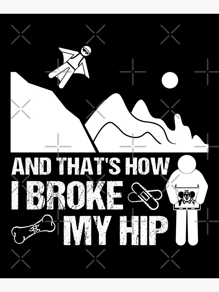 Lámina montada «Historia de la cadera rota fractura de cadera fractura ...