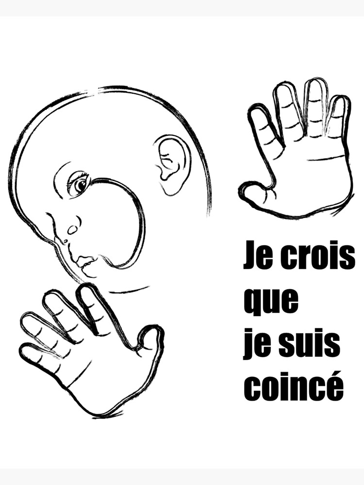 " Adorable Baby | Graphic illustration | I think i'm stuck" Poster for ...