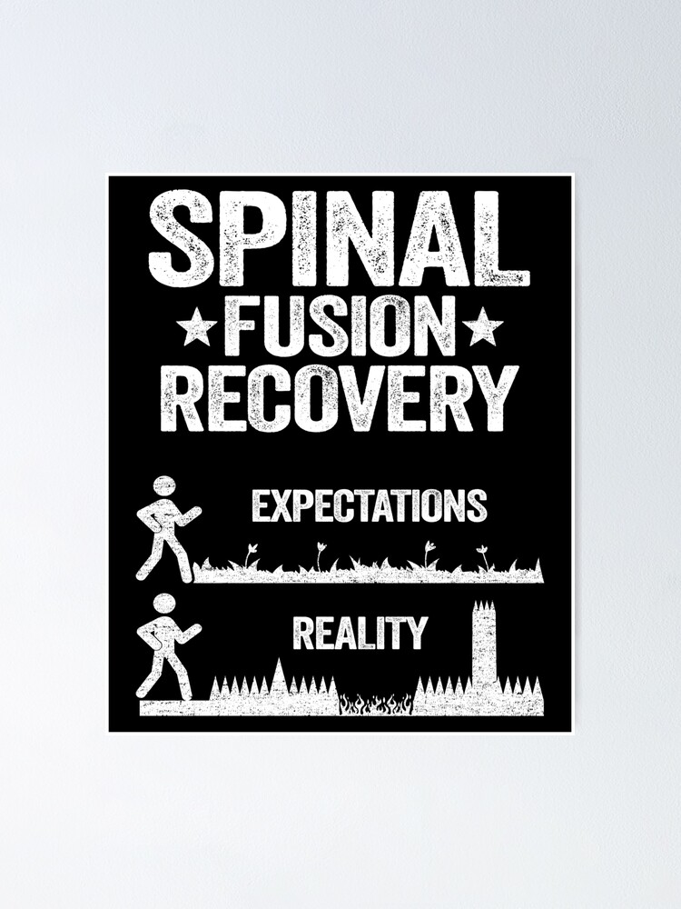 "Bionic Spine Surgery Lumber Spinal Fusion Back Recovery" Poster for ...