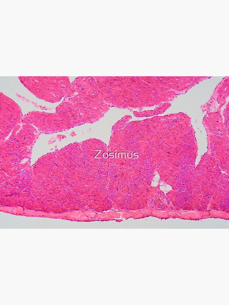 "Section of an atrial wall of a human heart in the microscope ...