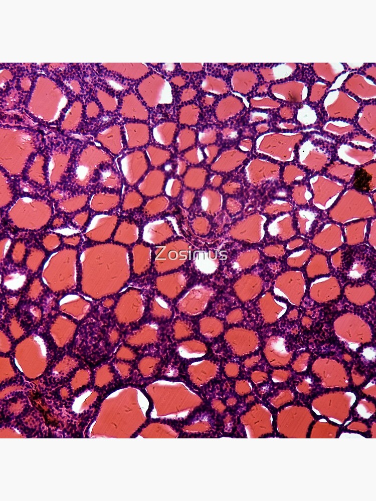 "Section of thyroid gland cells under the microscope" Pin for Sale by ...
