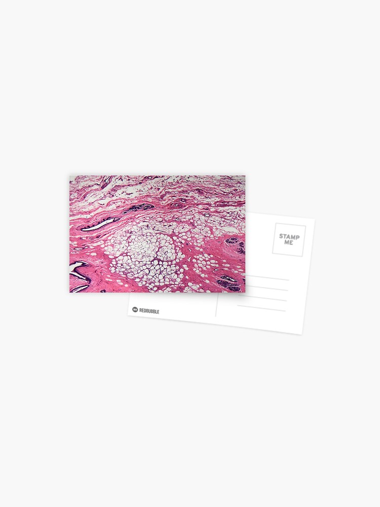 "Human mammary gland cells under the microscope" Postcard for Sale by ...