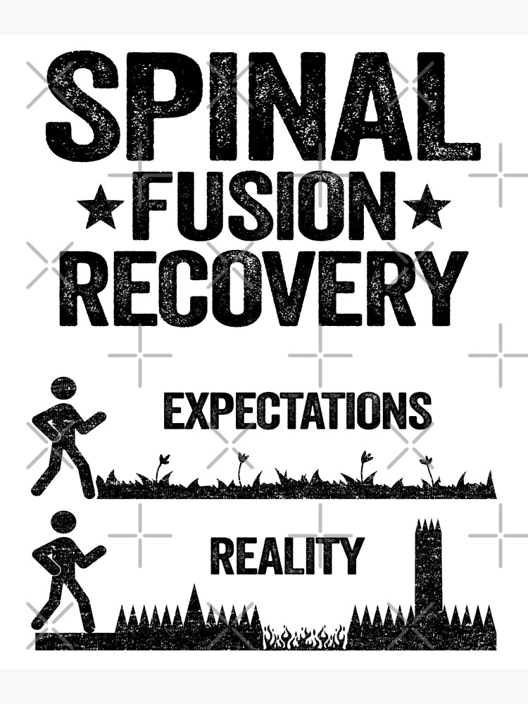 "Bionic Spine Surgery Lumber Spinal Fusion Back Recovery" Greeting Card ...