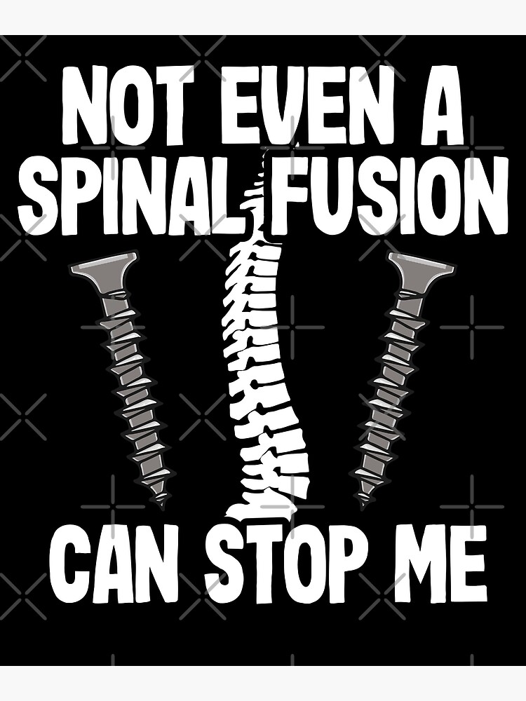 Spinal Fusion Memes I Don't Know If I Can Post Memes Here, But Here