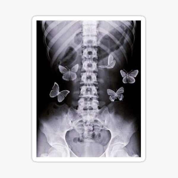 "x-ray aesthetic" Sticker for Sale by YuiQ | Redbubble