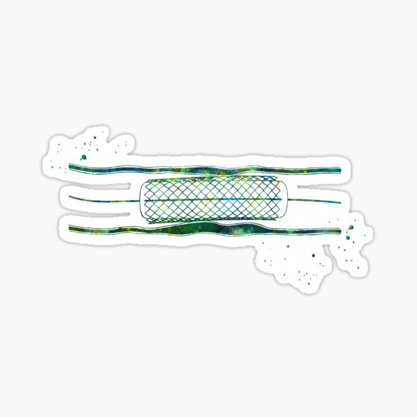 "Coronary Angioplasty Heart Stent" Sticker by EvasDreams | Redbubble