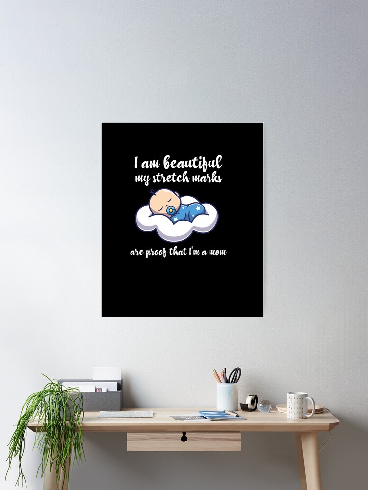 Cute Pregnancy Stretch Mark Quotes