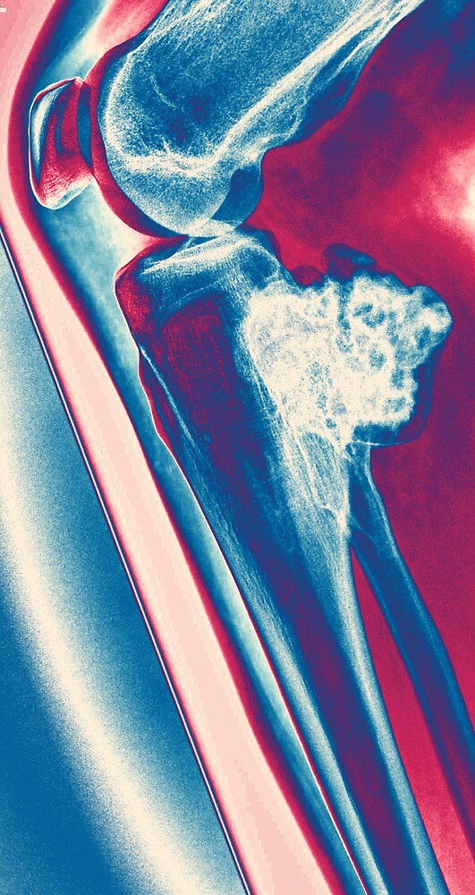 "x-ray red, white and blue" by freereinfineart | Redbubble