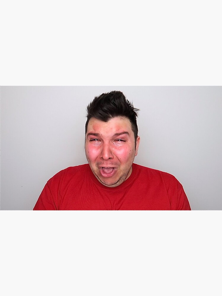 "Nikocado Avocado crying" Sticker for Sale by chaosxr | Redbubble