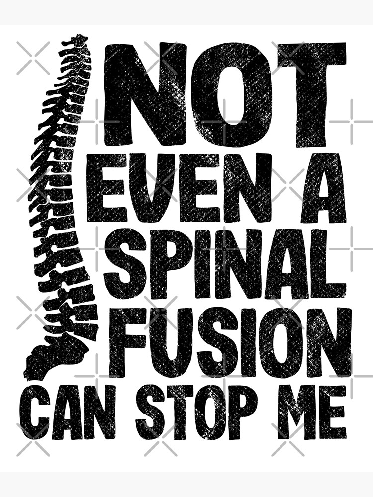 Spinal Fusion Quotes Exceptional Teen Helps Others After Spinal Fusion
