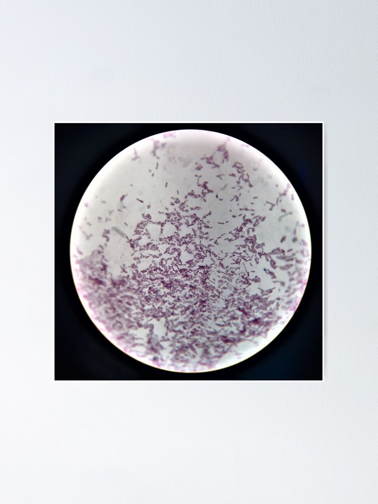 ""Bacillus cereus Endospore Stain #2"" Poster by amethystinum | Redbubble