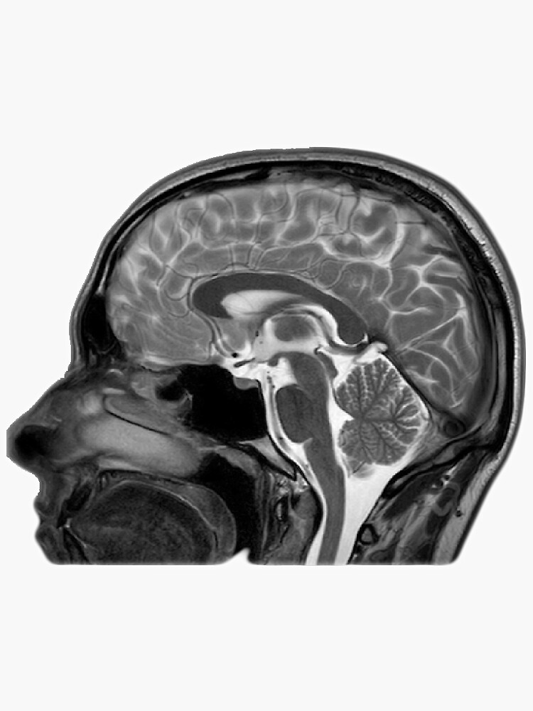 "Human Brain Side MR-image" Sticker for Sale by Pisoglort | Redbubble