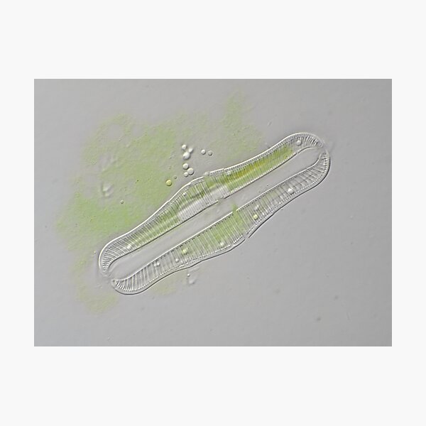 "Freshwater diatom, Rhopalodia sp." Photographic Print for Sale by Sergii Dymchenko | Redbubble