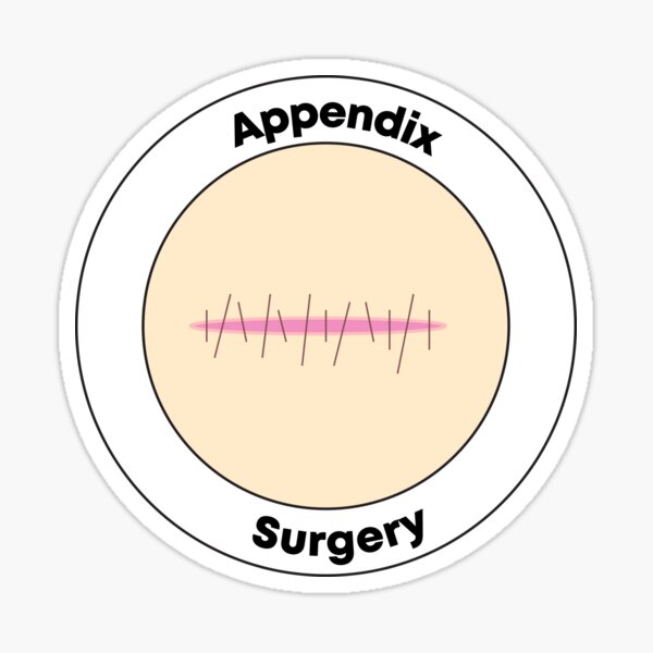 "appendix surgery" Sticker for Sale by DesignCREVTOR | Redbubble