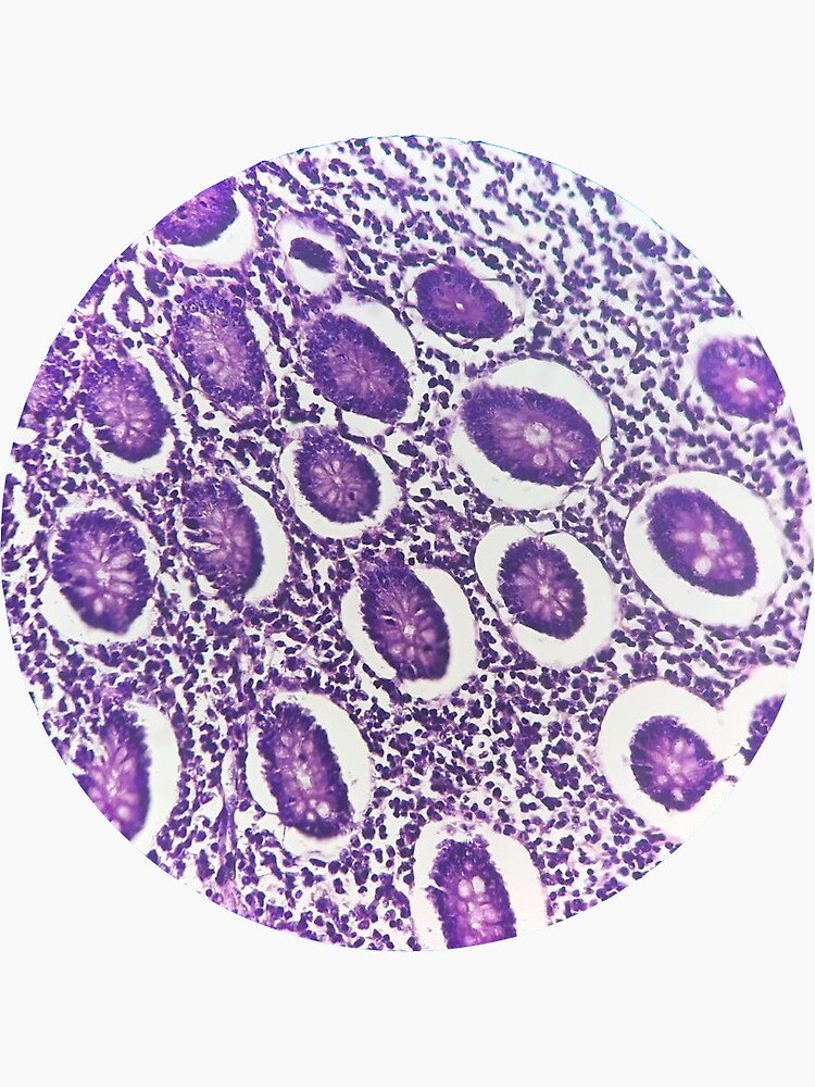 "Histology Pattern " Sticker for Sale by Kimbergine | Redbubble