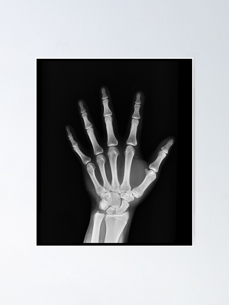 "X-Ray Skeleton Hand" Poster for Sale by CRECK | Redbubble