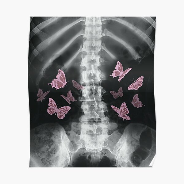 "Xray Skeleton Pink Butterfly Egirl y2k Harajuku Dark Grunge - Gothic ...