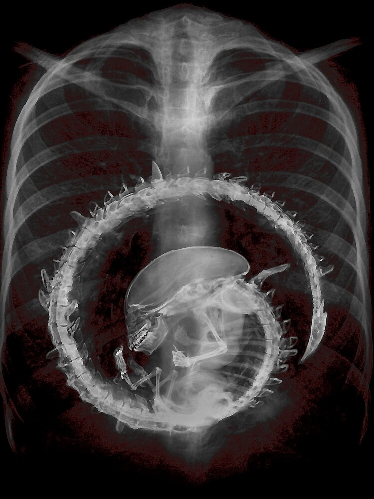 "Alien radiography v2, Alien X-ray v2" Art Print for Sale by ...