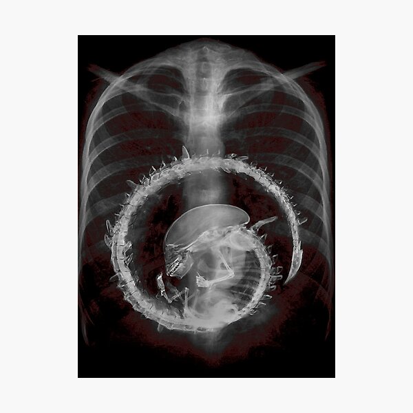 "Alien radiography v2, Alien X-ray v2" Photographic Print by ...