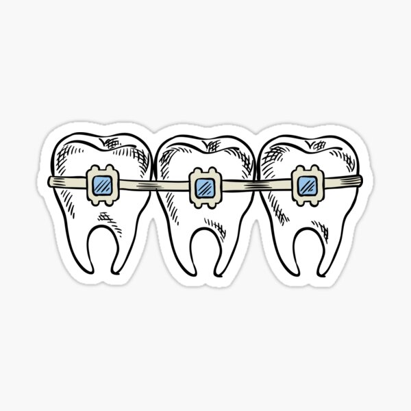 " Braces " Sticker for Sale by SkiniB | Redbubble