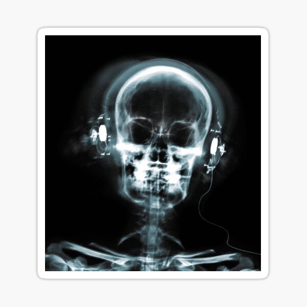 X Ray Stickers | Redbubble