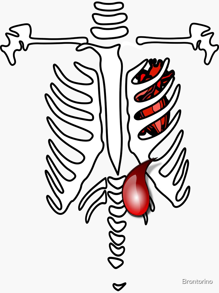 "Skeleton bleeding realistic" Sticker for Sale by Brontorino | Redbubble