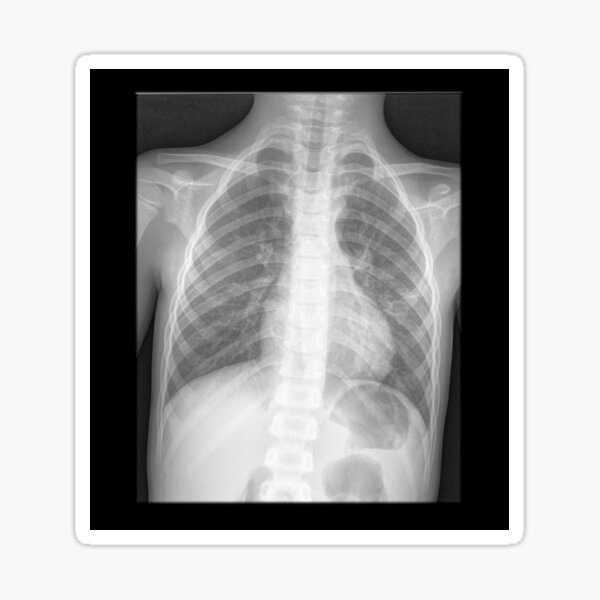 "x-ray" Sticker for Sale by Claraveritas | Redbubble