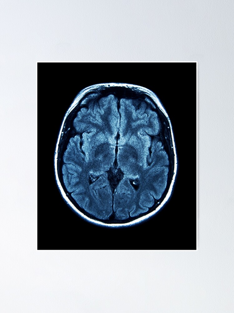 "Brain MRI x-ray" Poster for Sale by gmstockstudio | Redbubble