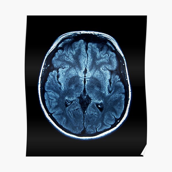 "Brain MRI x-ray" Poster for Sale by gmstockstudio | Redbubble