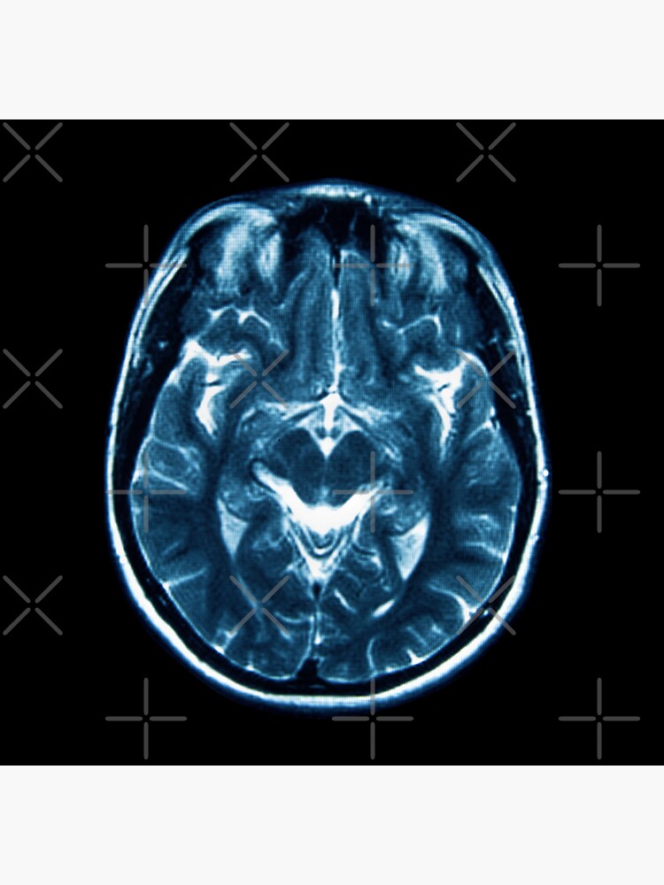 "Brain MRI x-ray" Sticker for Sale by gmstockstudio | Redbubble
