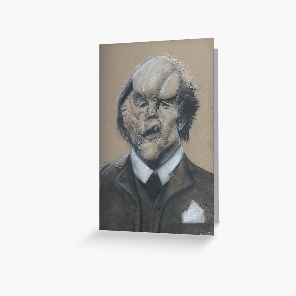 "John Hurt as Joseph Merrick (The Elephant Man)" Greeting Card for Sale ...